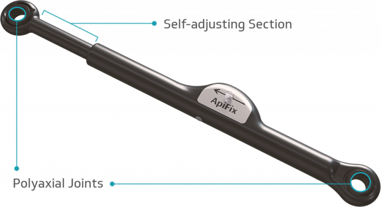 ApiFix Procedure | Overview for Healthcare Professionals